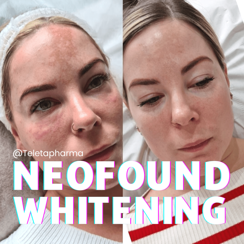 Neofound Whitening - Teleta Pharma